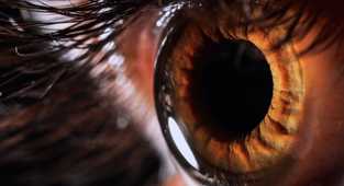 About MacTel | Uncovering MacTel DSE Website